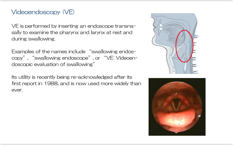 28.Overview, Necessary Supplies, and Management of Videoendoscopy