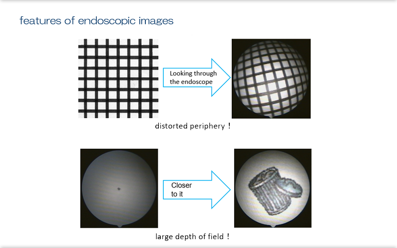 28.Overview, Necessary Supplies, and Management of Videoendoscopy