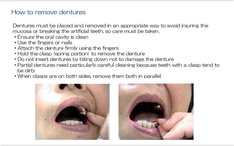 38.Oral Care Preparations, Teeth Cleaning, and Equipment and Chemicals