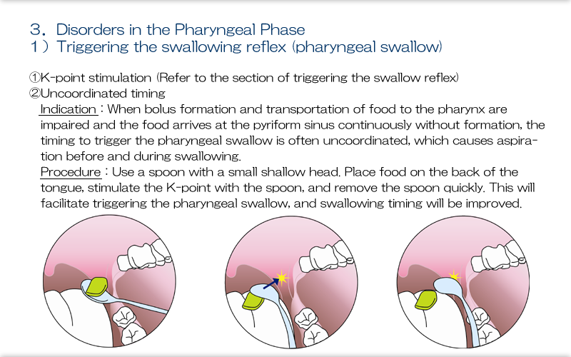 56.Direct therapy at mealtimes